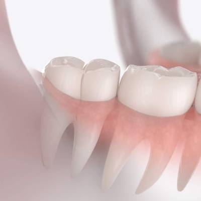 Kako ublažiti bol i nelagodu tijekom rasta umnjaka